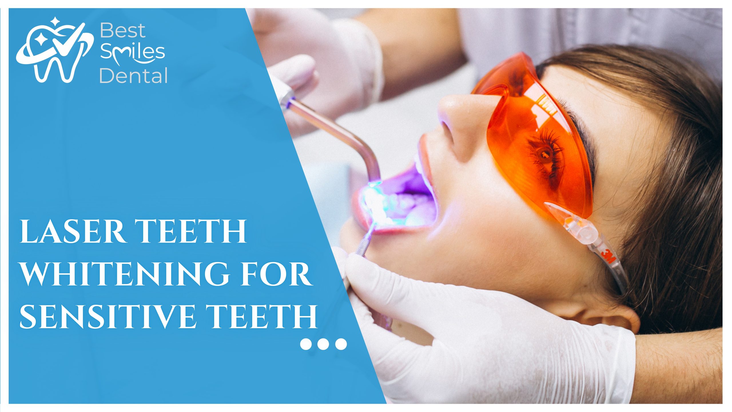 Laser Teeth Whitening for Sensitive Teeth: What You Need to Know