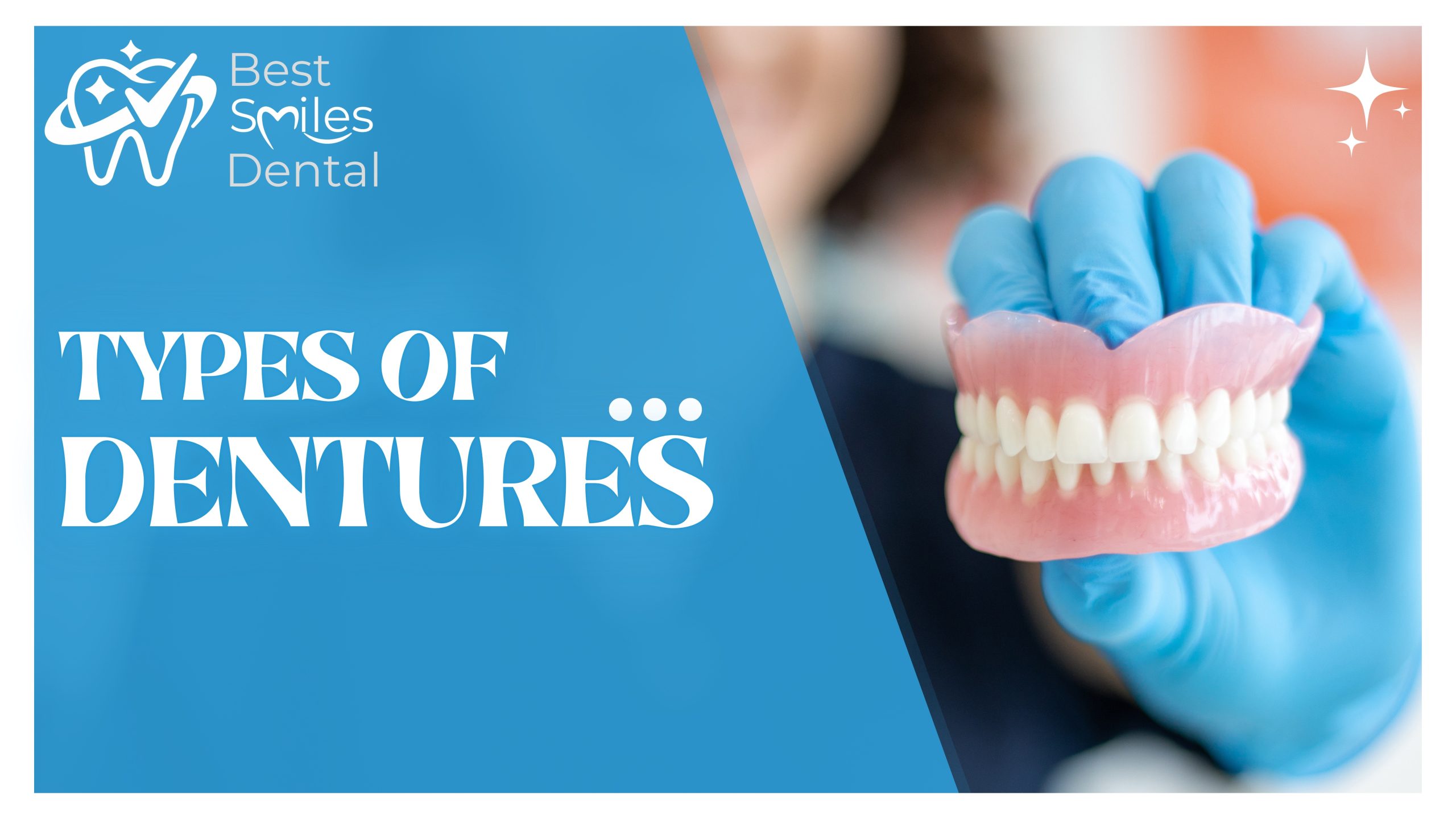 Types of Dentures Explained: Full, Partial, Hybrid and Immediate Options