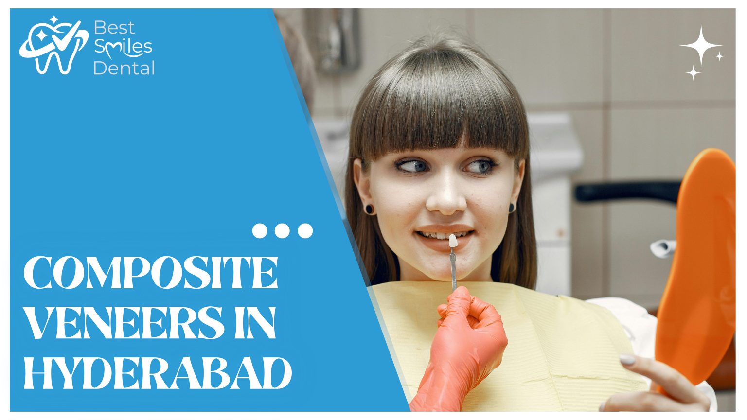 How Long Do Composite Veneers Last? Maintenance and Durability Tips