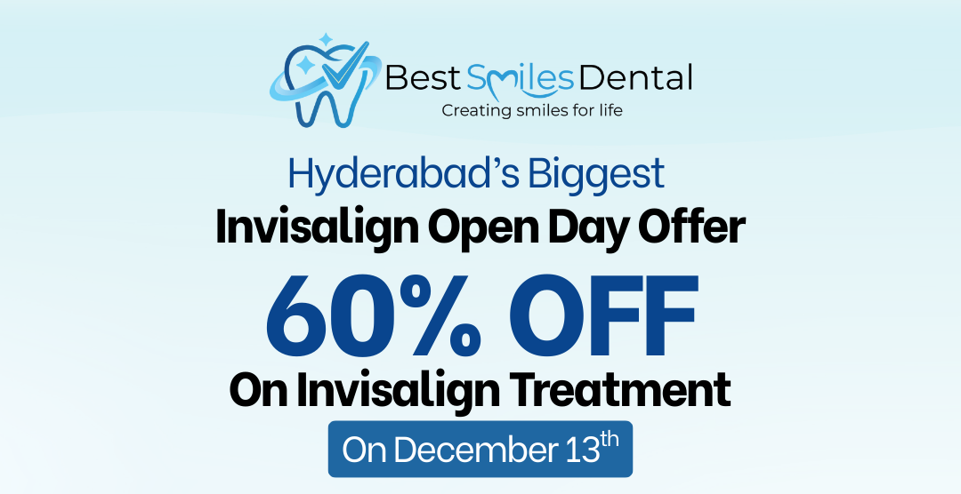 December 13th, 2025 Invisalign Mega Event: Hyderabad’s Biggest ...