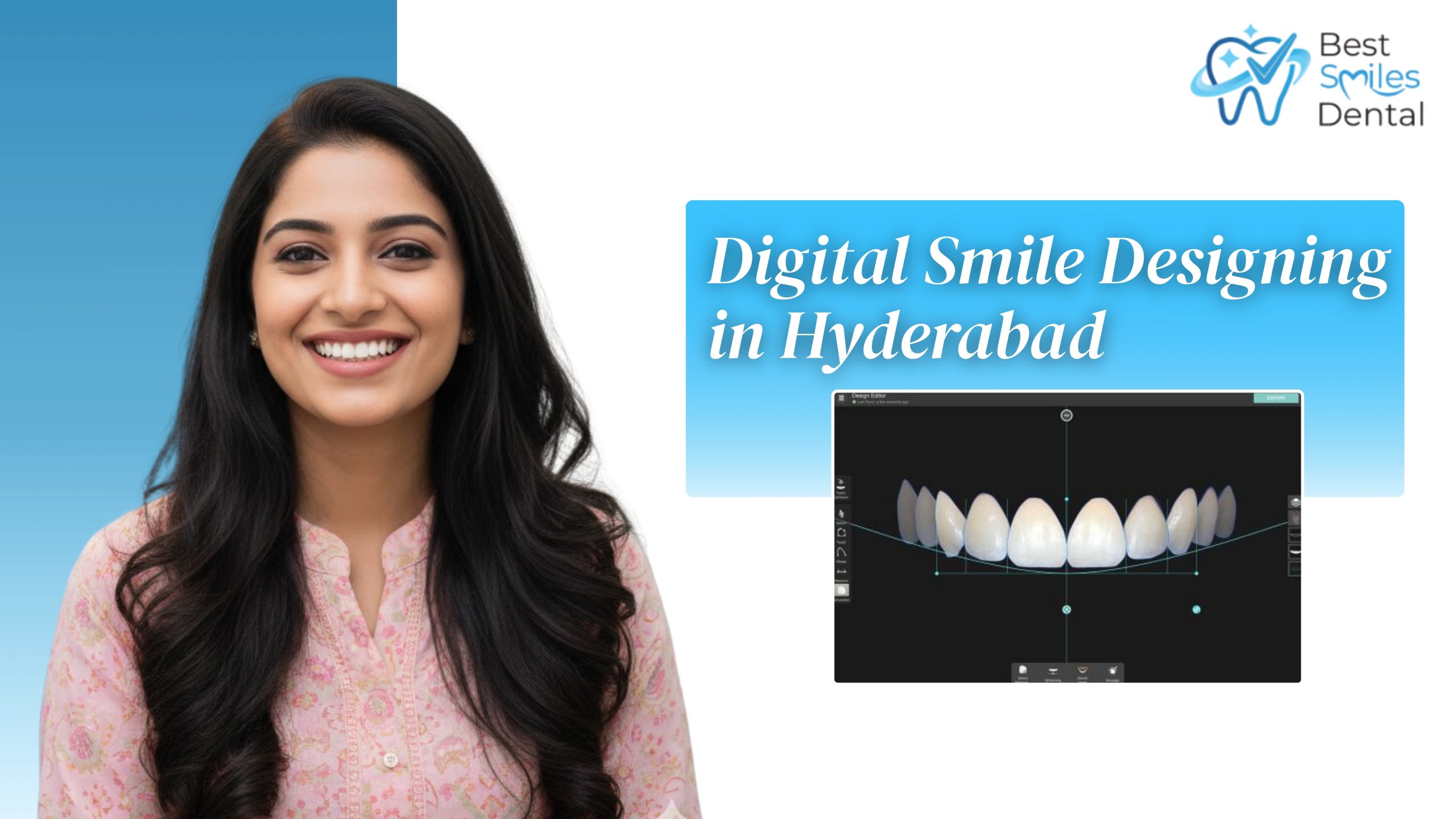 Digital Smile Designing in Hyderabad - Procedure & Benefits