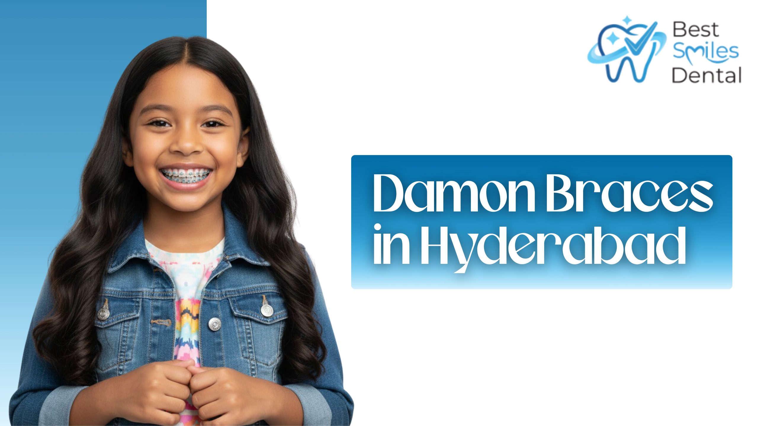 Damon Braces in Hyderabad, Faster and More Comfortable Teeth Straightening